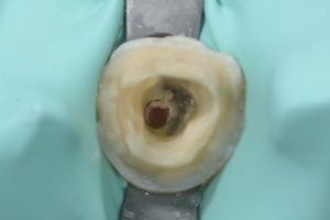 Core build-up – campaigns-gceurope