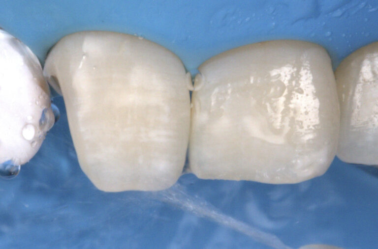 G-Premio BOND – campaigns-gceurope