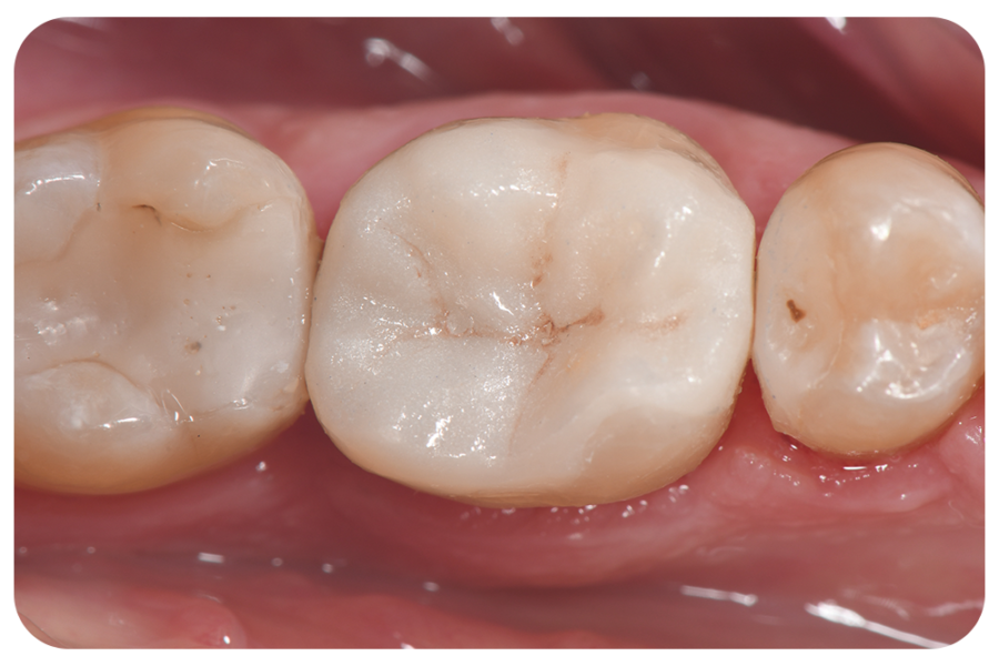 Initial LiSi Block – campaigns-gceurope