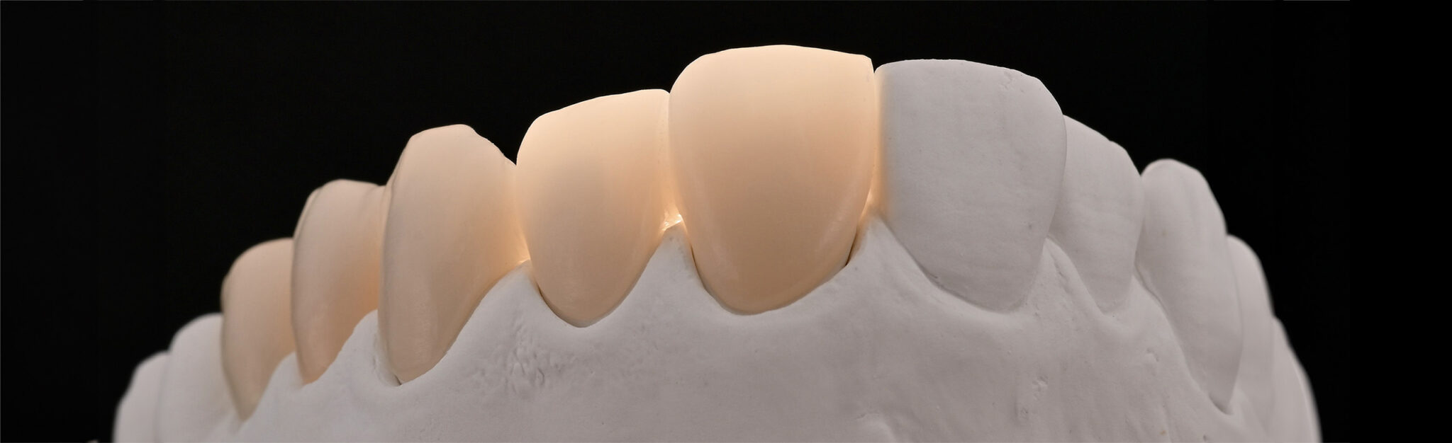 Zirconia Solutions – campaigns-gceurope